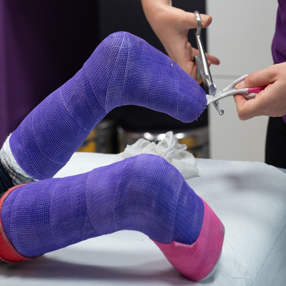 Clubfoot - Paley Europe - You Deserve The Best!